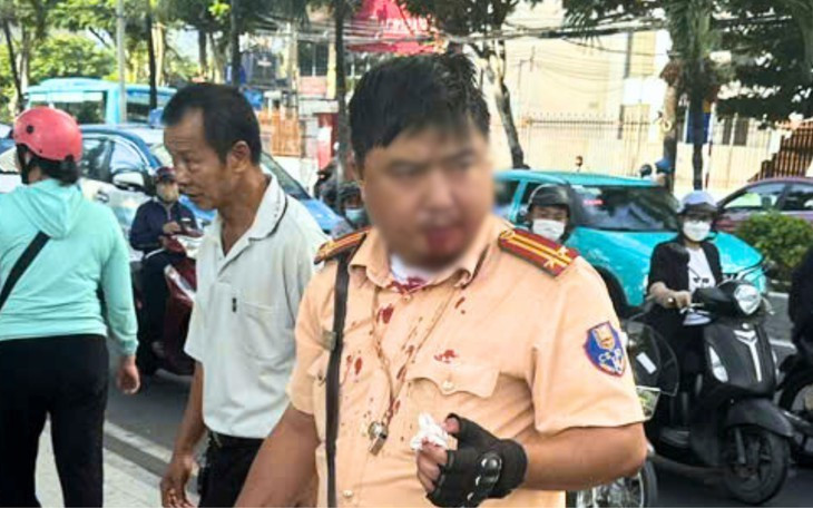 Khởi tố vụ say rượu đấm cảnh sát giao thông: Thanh niên người Nga có được hưởng tình tiết giảm ...