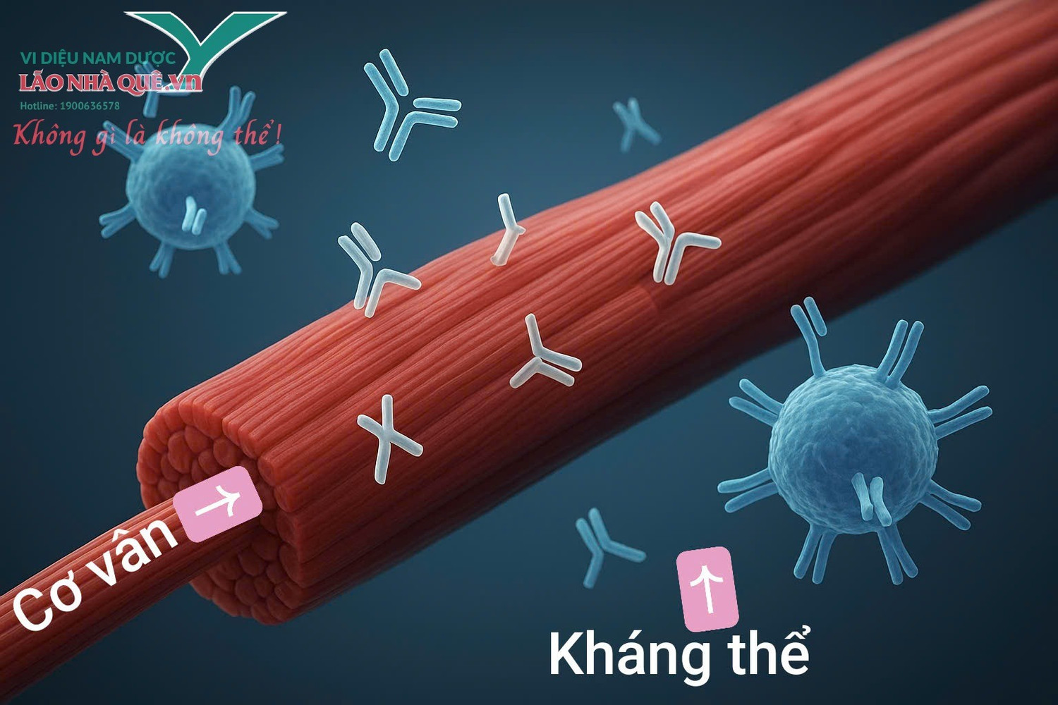 Kháng thể tự miễn tiêu cơ vân hướng phục hồi từ trị liệu khai thông cột ...